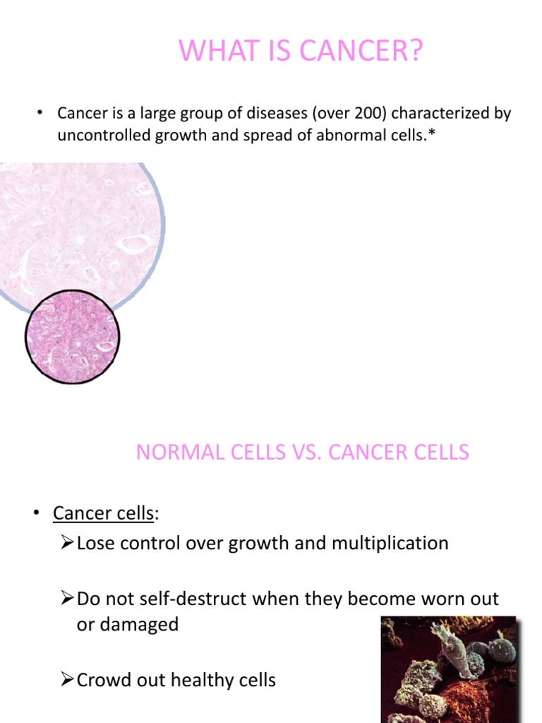 What Is Cancer | PDF | Cancer | Neoplasms