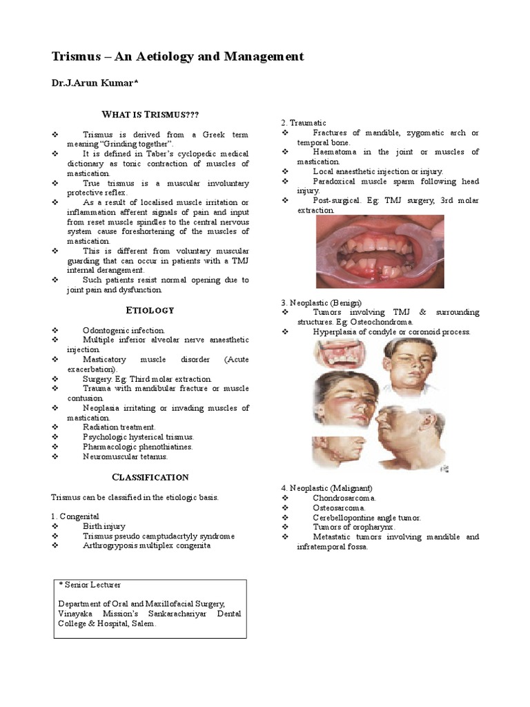 Trismus - An Aetiology and Management | PDF | Arthritis | Pain