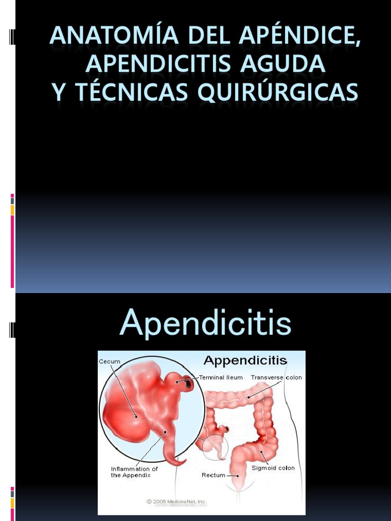 Anatomía Del Apéndice, Apendicitis Aguda Y Técnicas Quirúrgicas ...