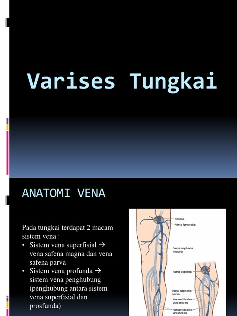 Varises Tungkai | PDF | Sains & Matematika