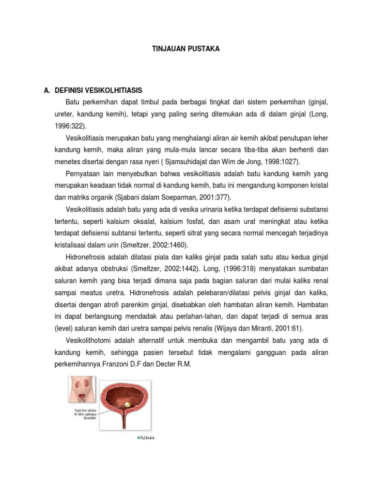 LP Vesikolithiasis | PDF