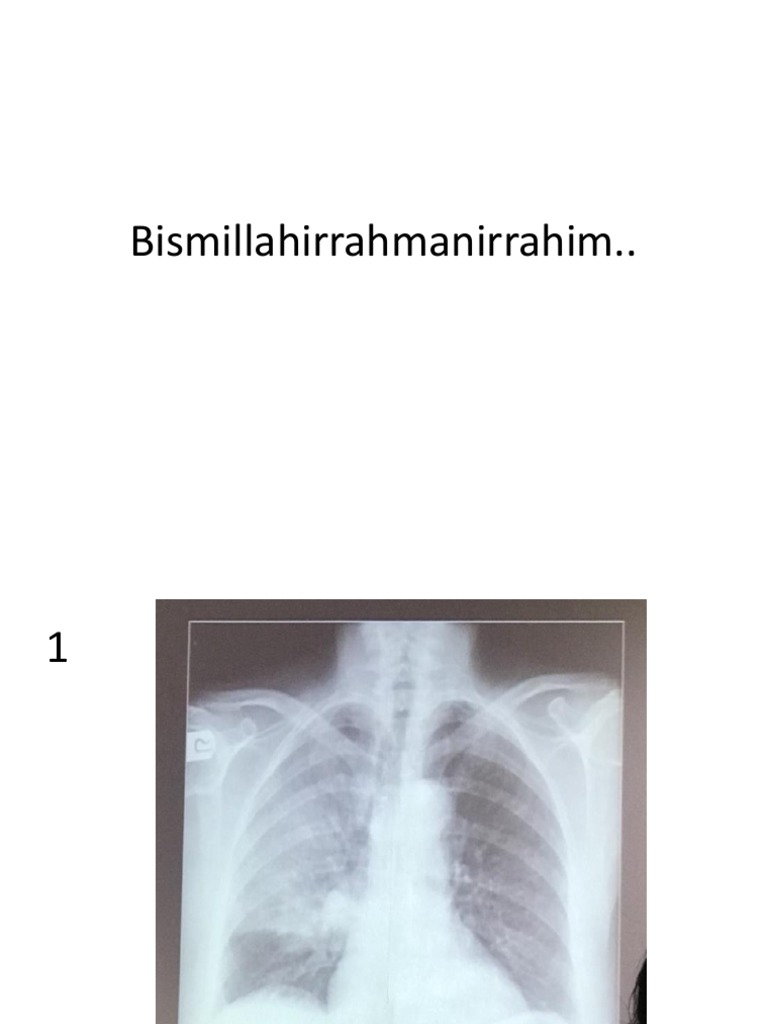 Temuan Rontgen Paru dan Diafragma | PDF