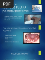 Protocolo de Biopulpectomía y Necropulpectomía | PDF