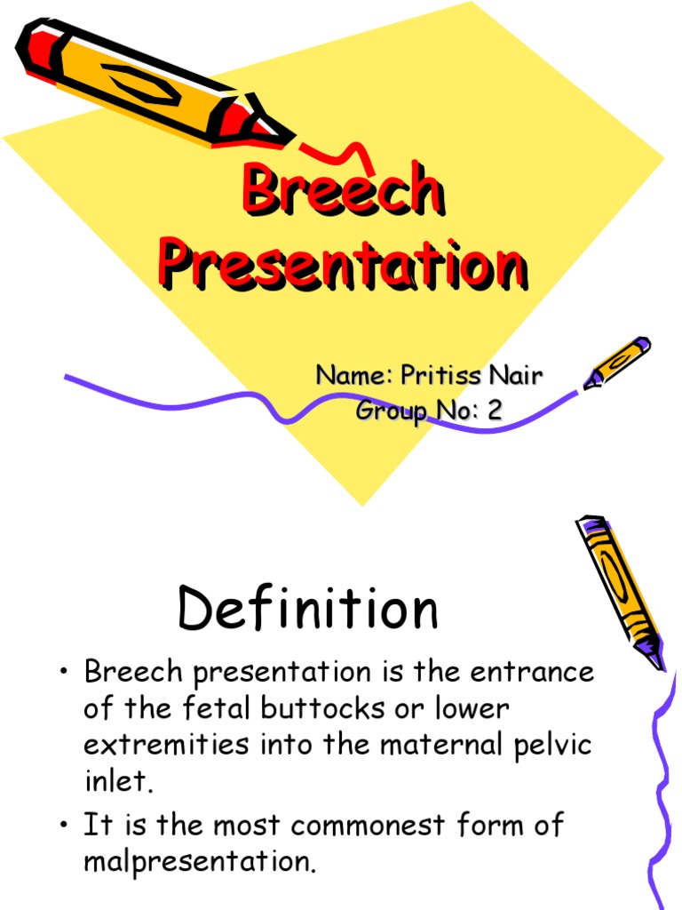 Understanding Breech Presentation in Birth | PDF | Human Pregnancy | Pelvis