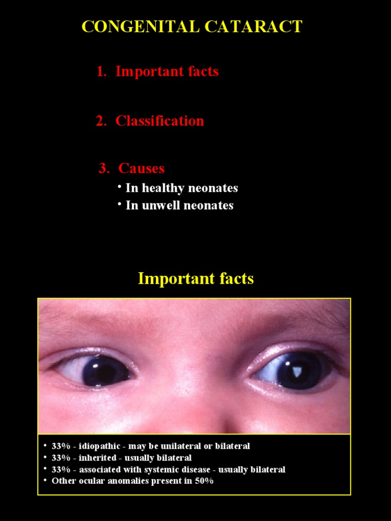 Congenital Cataract: 1. Important Facts | PDF | Cataract | Diseases Of The Eye And Adnexa