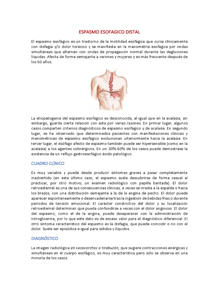 Espasmo Esofagico Distal | Enfermedades y trastornos | Medicina CLINICA