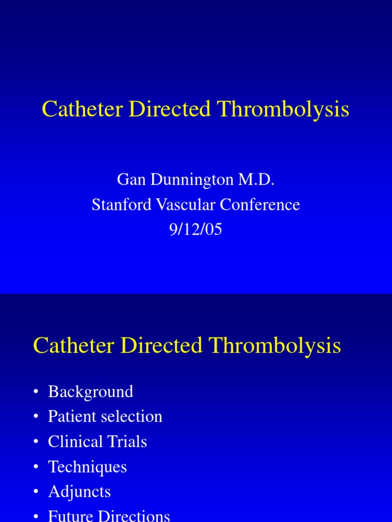 Catheter Directed Thrombolysis: Gan Dunnington M.D. Stanford Vascular ...