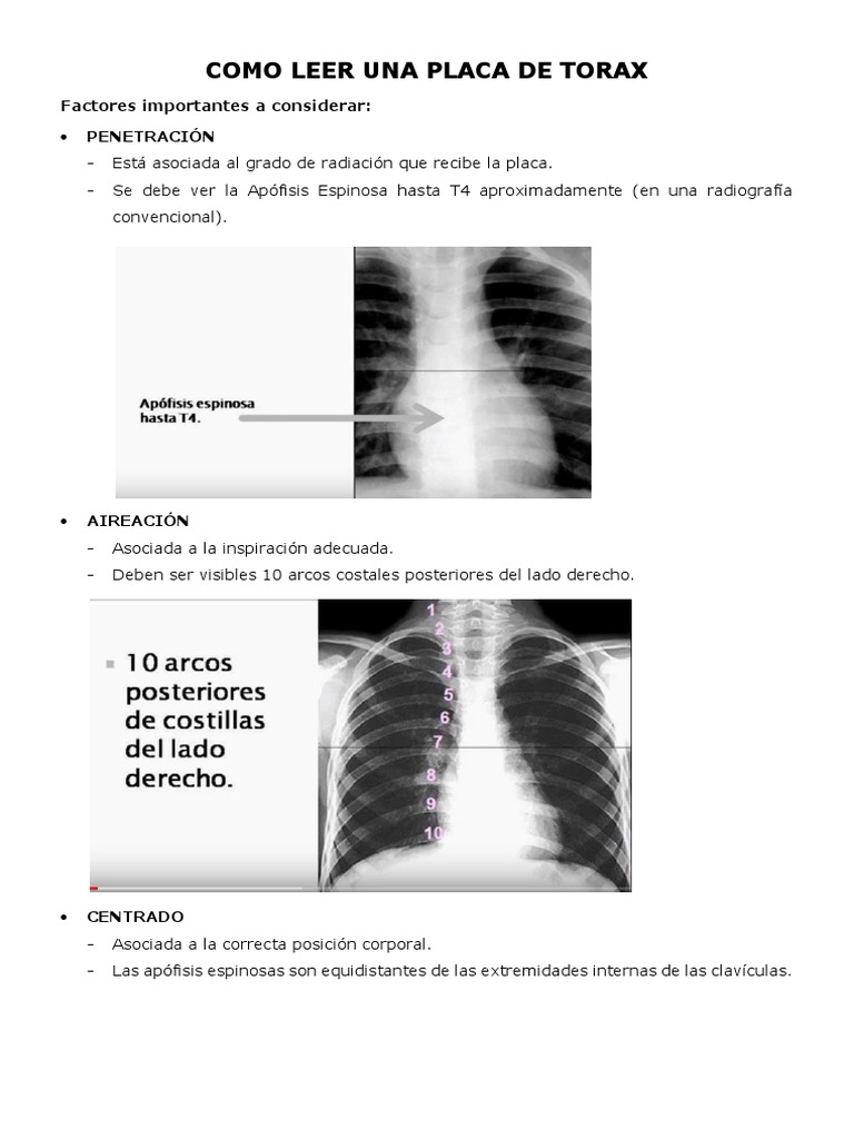 Como Leer Una Placa de Torax y Estructuras Basicas Anatomicas | Rayos x ...