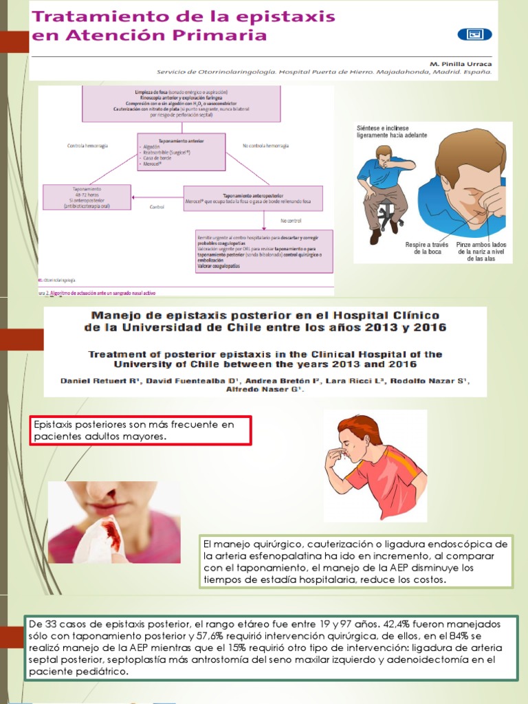 Tratamiento Epistaxis | PDF | Medicina | Medicina CLINICA