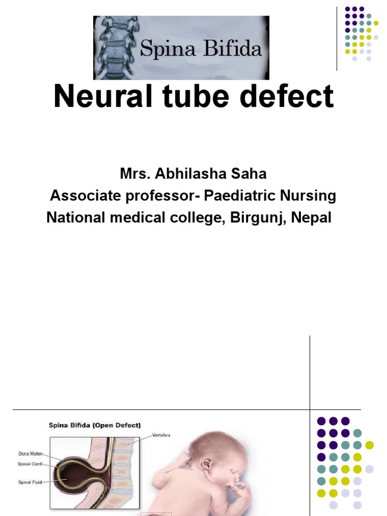 Neural Tube Defect: Mrs. Abhilasha Saha Associate Professor-Paediatric ...
