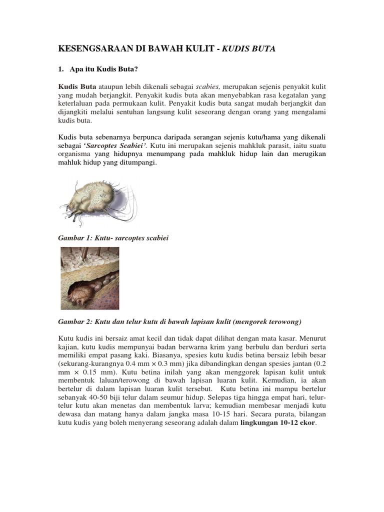SCABIES Malay DR Sabeera Final | PDF