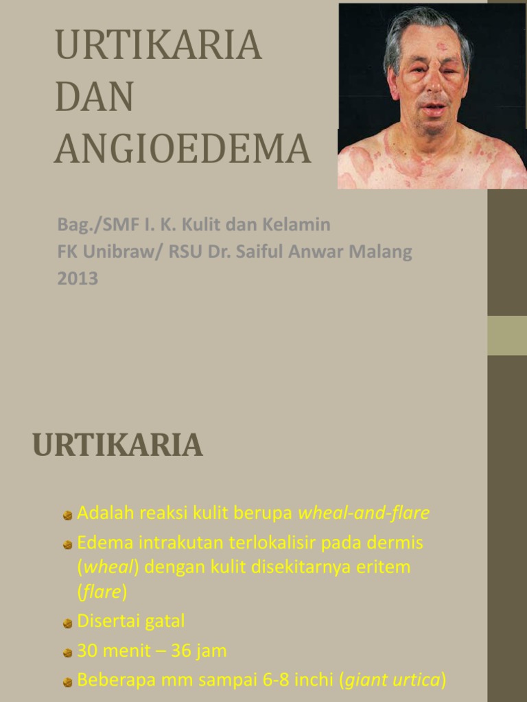 Urtikaria Dan Angioedema | PDF