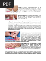 Anatomía de La Uña y Sus Partes | PDF | Clavo (anatomía) | Sistema ...