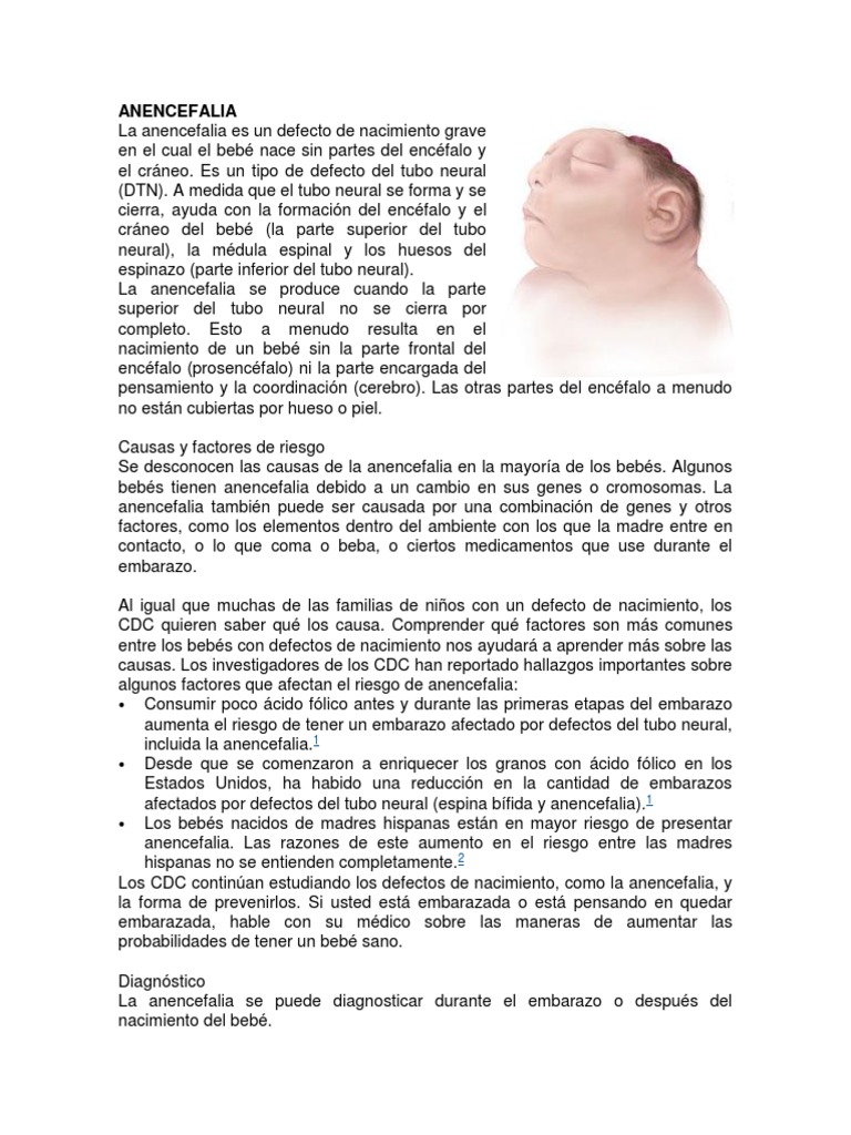Anencefalia: Causas y Diagnóstico | PDF | Especialidades Medicas ...