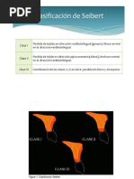 Clasificación de Seibert del Reborde Alveolar | PDF | Ciencia y matemáticas