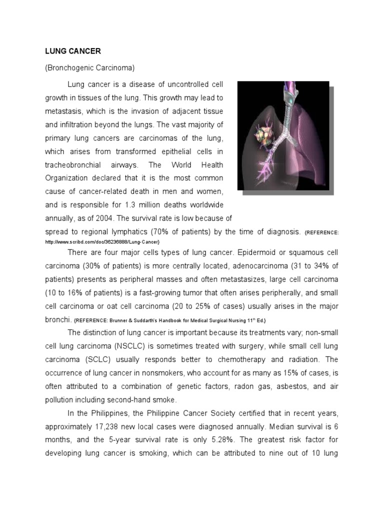Lung Cancer Pathophysiology and Risk Factors | PDF | Lung Cancer | Cancer