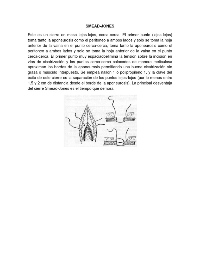 Descripción del método quirúrgico de cierre Smead-Jones para incisiones ...