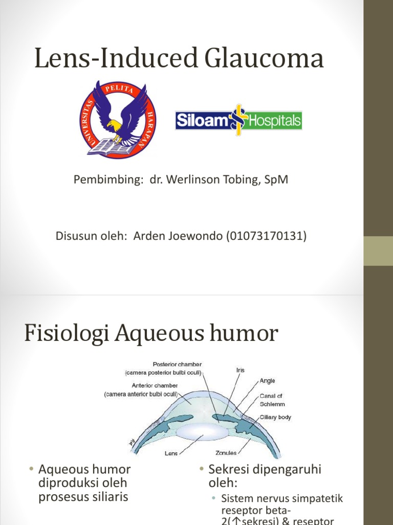 Lens-Induced Glaucoma | PDF | Teknologi & Rekayasa