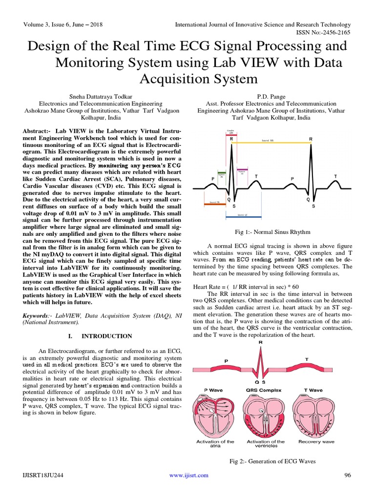 Design Of The Real Time Ecg Signal Processing And Monitoring System