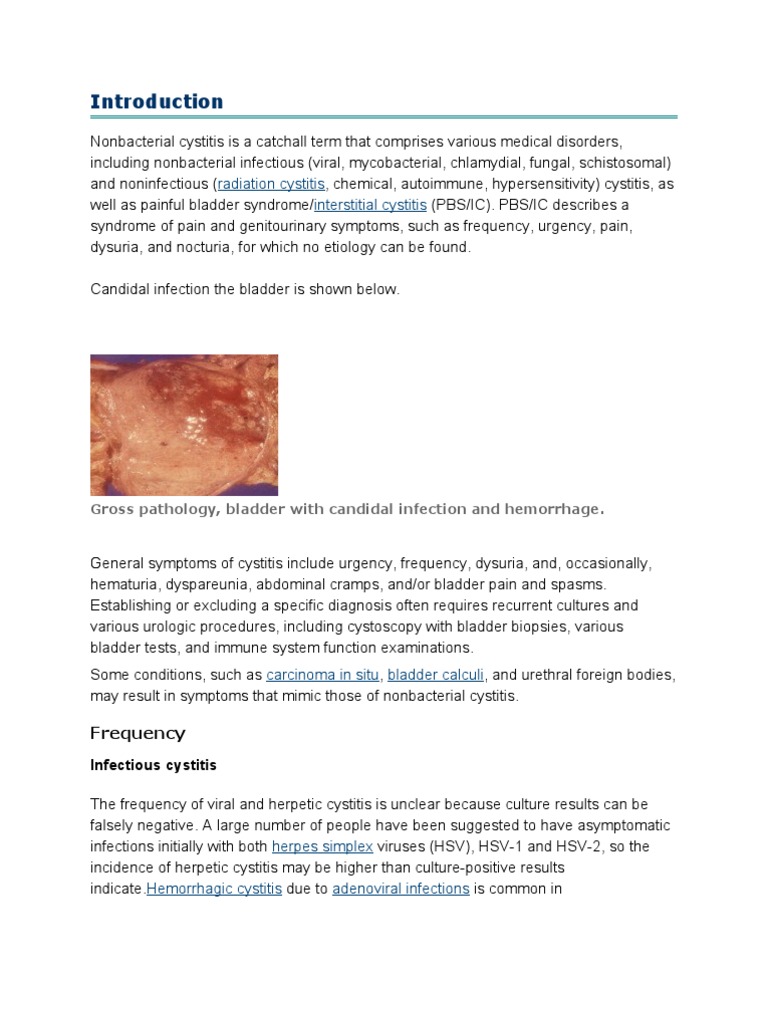 CYSTITIS! | PDF | Urinary Tract Infection | Health Sciences