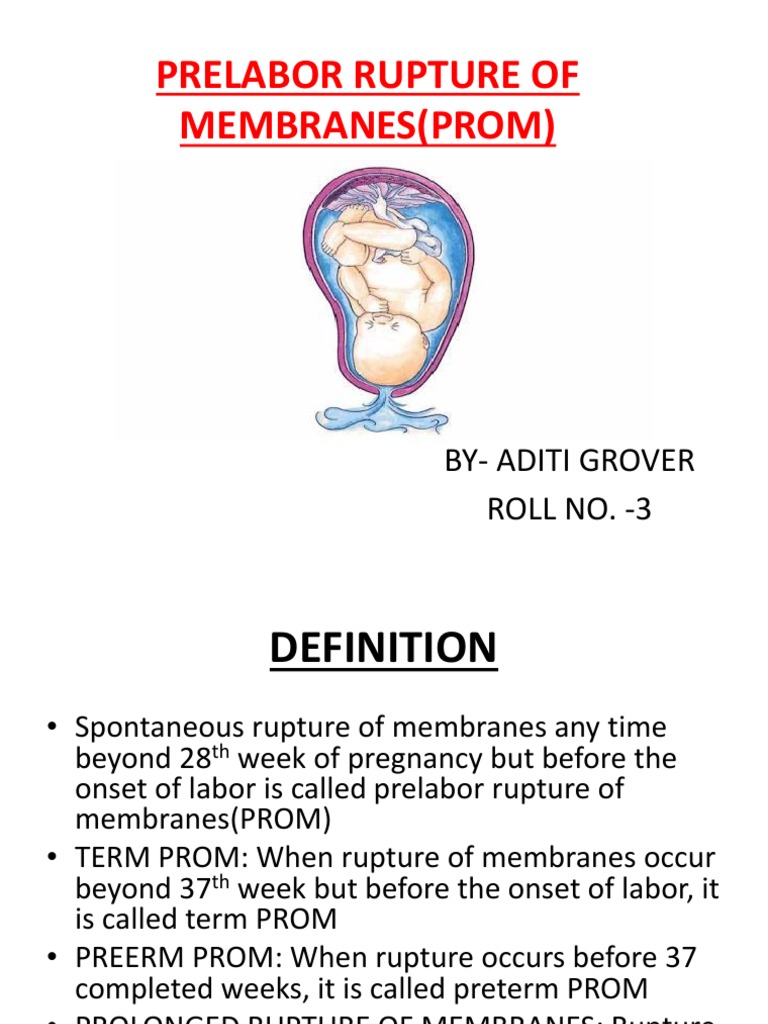 Prelabor Rupture of Membranes (Prom) : By-Aditi Grover Roll No. - 3 ...