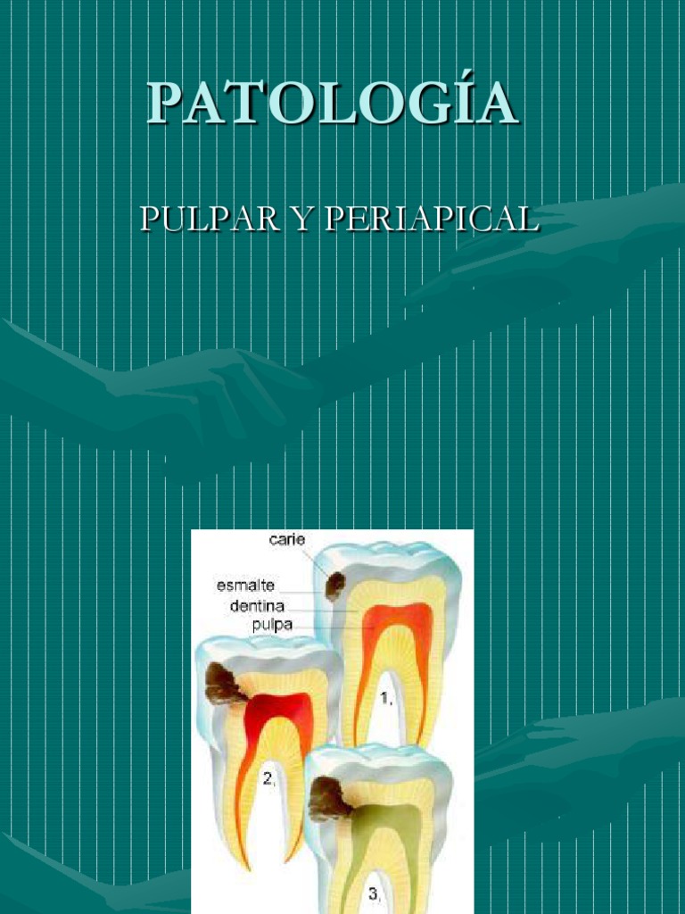 Patología Pulpar y Periapical | PDF | Enfermedades y trastornos | Inmunología