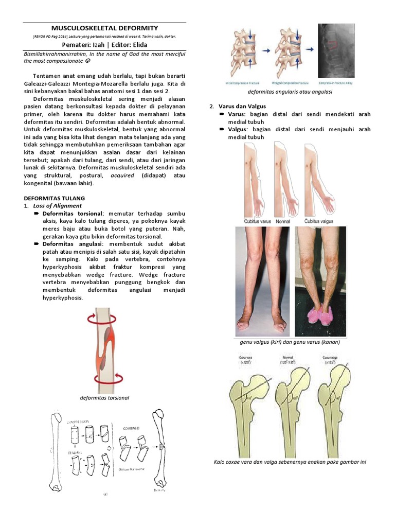 Musculoskeletal Deformity | PDF