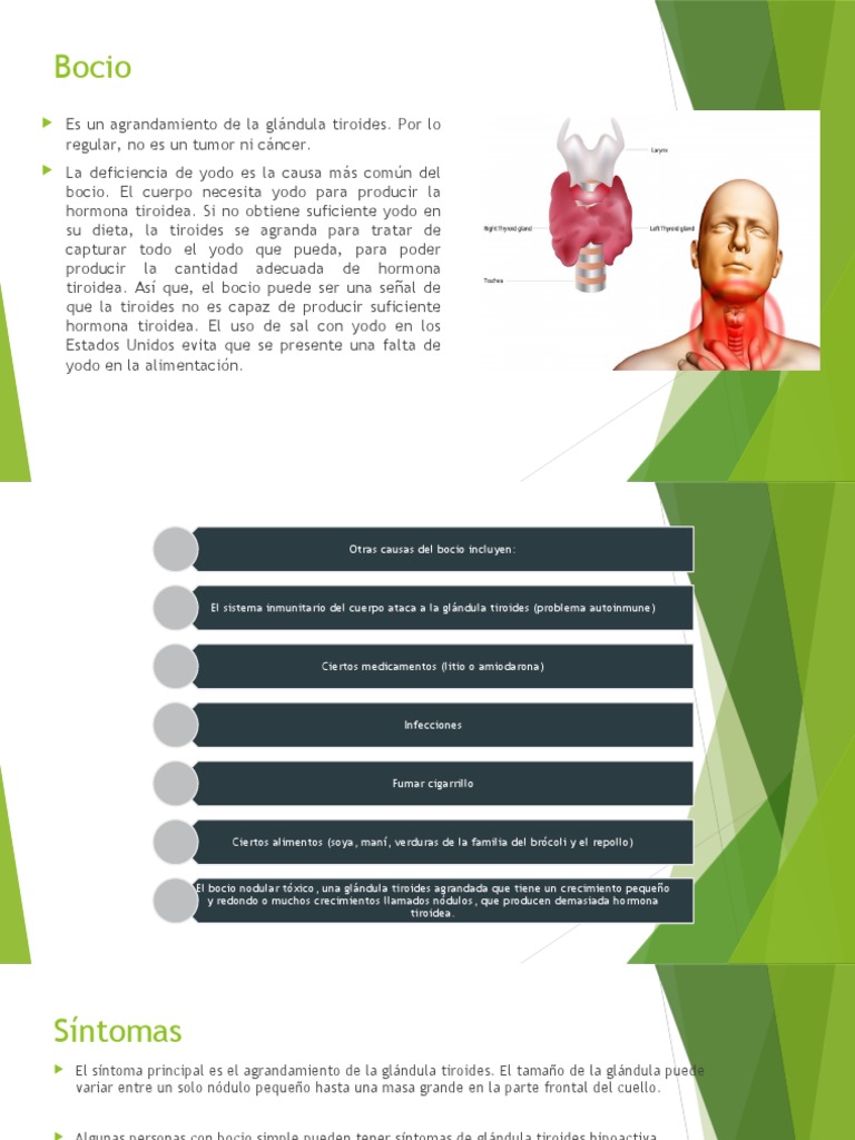 Bocio Segun OMS | PDF | Tiroides | Yodo