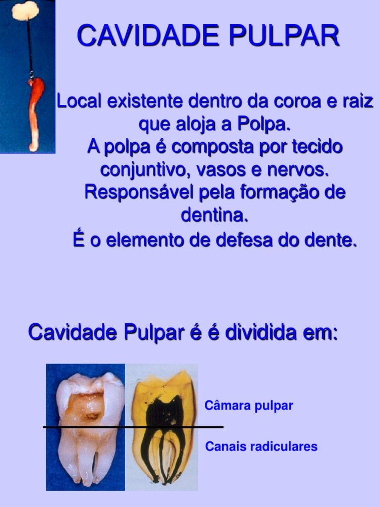 Anatomia Da Cavidade Pulpar | PDF | Dentina | Dente