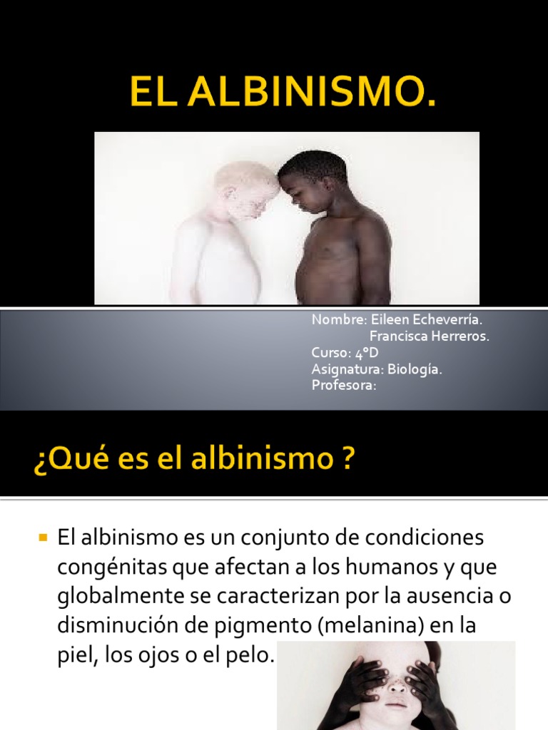 El Albinismo | PDF | Medicina CLINICA | Enfermedades y trastornos
