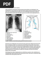 PDF Anatomi Thorax Normal Gambaran Radiologi Compress | PDF