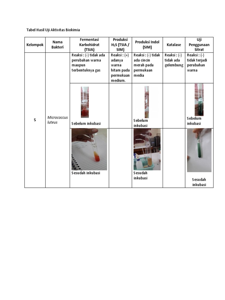 Tabel Hasil Uji Aktivitas Biokimia KLMPK 5 | PDF