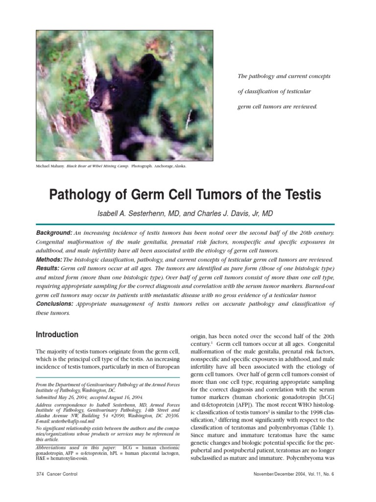 Tumori Testisa PDF | PDF | Metastasis | Carcinoma