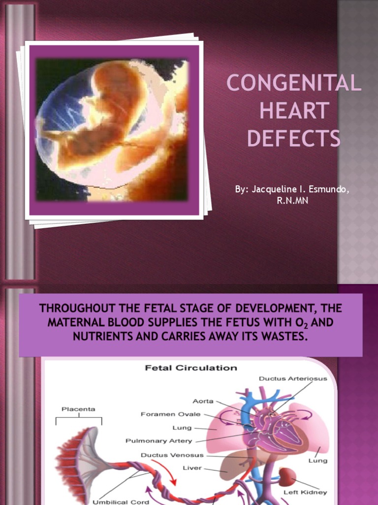 Classification and Management of Congenital Heart Anomalies | PDF ...