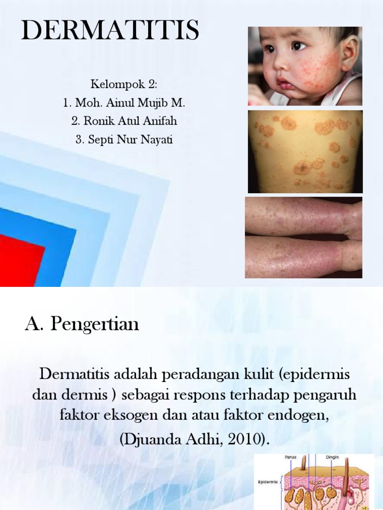 Panduan Lengkap Dermatitis dan Penanganannya | PDF | Kesehatan Holistik