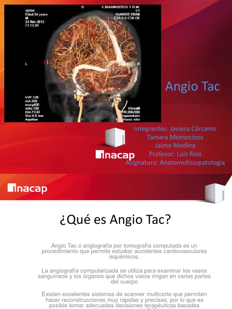 Qué es el Angio Tac y su uso | PDF | Salud y bienestar | Ciencia y ...