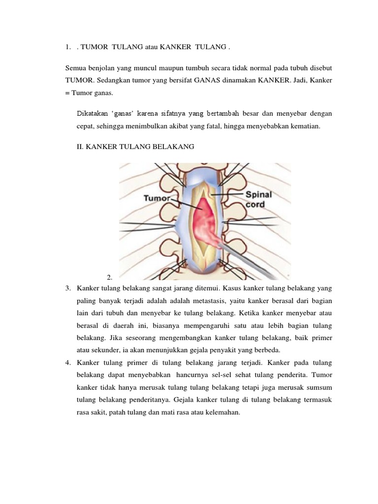 Gejala Kanker Tulang Belakang | PDF