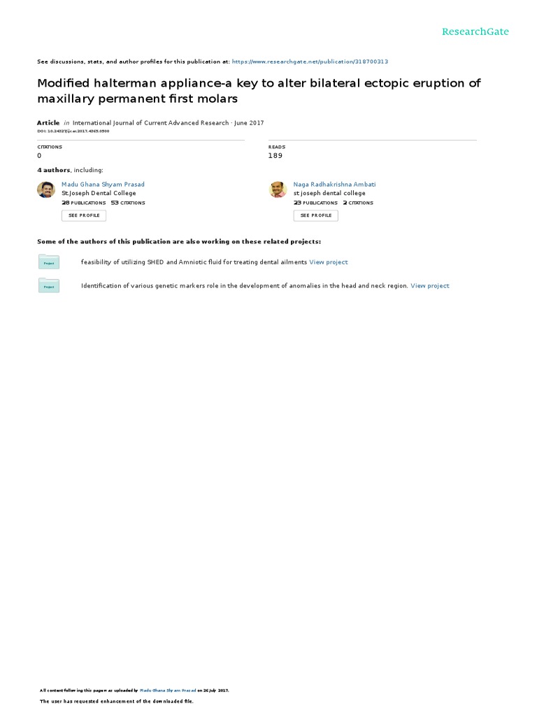 Modified Halterman Appliance-A Key To Alter Bilateral Ectopic Eruption ...