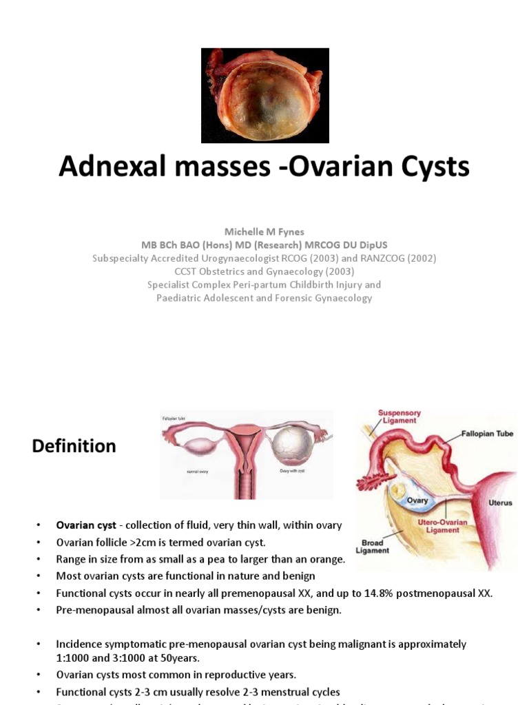 Adnexal Masses - Ovarian Cysts (2008) | PDF | Ovarian Cancer | Women's ...