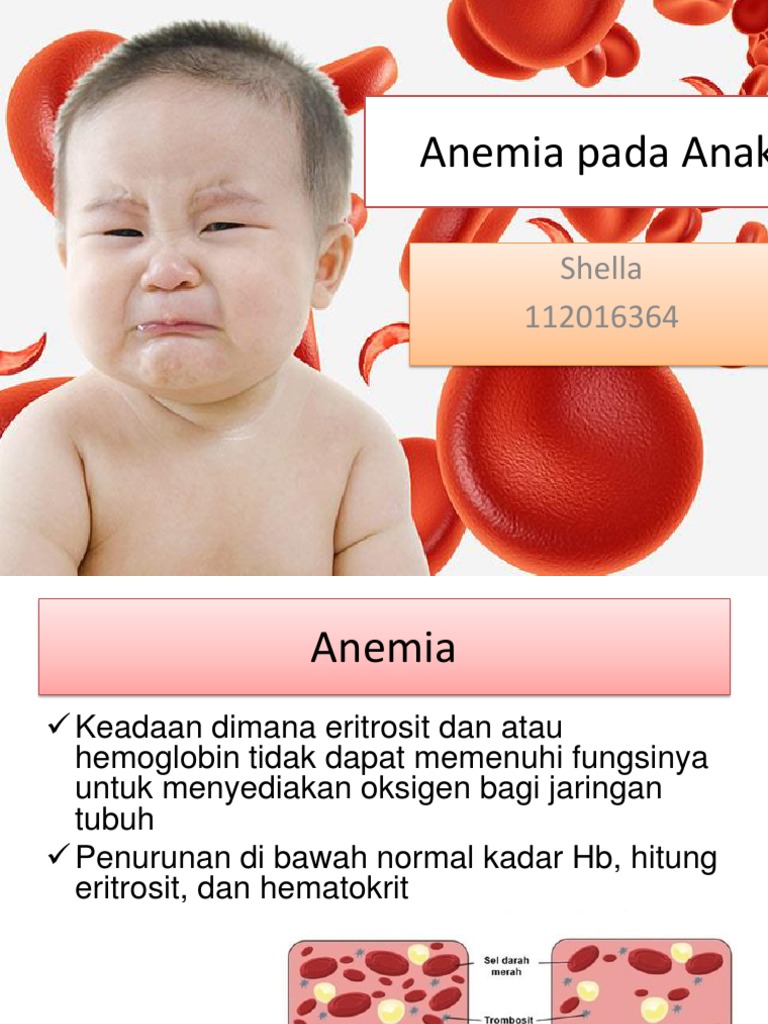 Anemia Pada Anak | PDF
