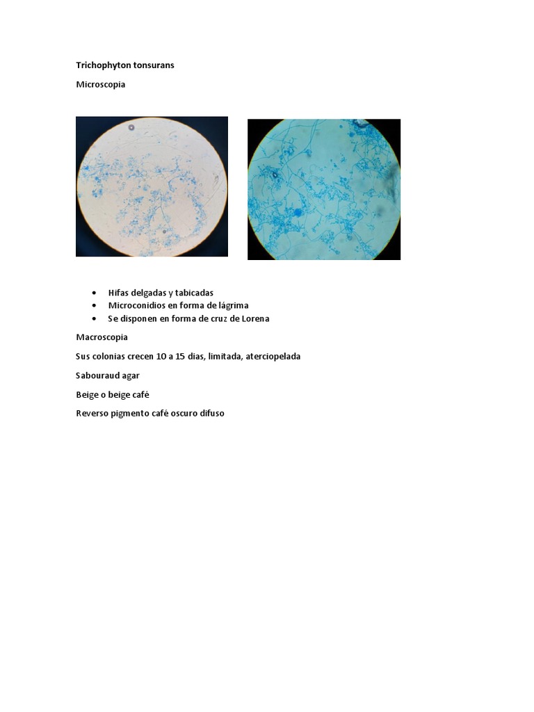 Trichophyton Tonsurans | PDF