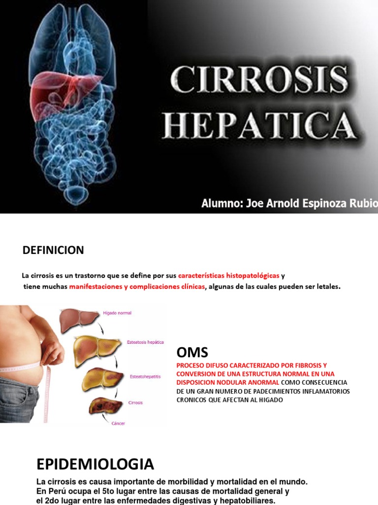 Cirrosis Hepatica - Joe Espinoza | PDF | Cirrosis | Hepatitis