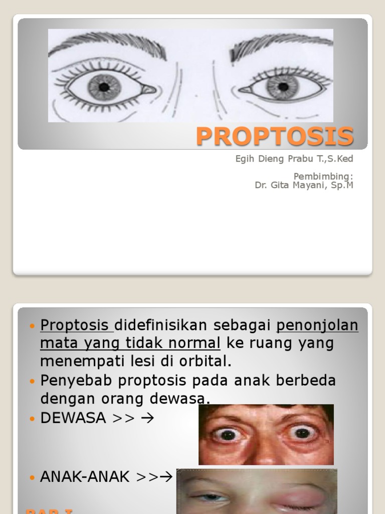 Penyebab dan Jenis Proptosis Mata | PDF