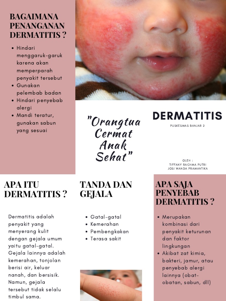 Penanganan dan Gejala Dermatitis Anak | PDF