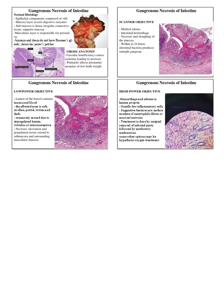 Gangrenous Necrosis of Intestine | PDF | Necrosis | Gastrointestinal Tract