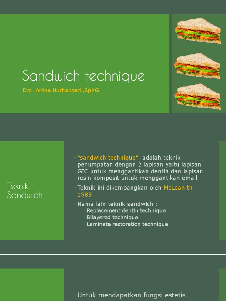 Sandwich Technique New | PDF