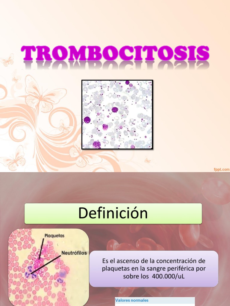 TROMBOCITOSIS | PDF | Plaqueta | Especialidades Medicas