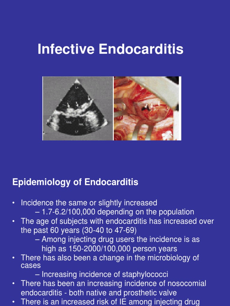 Infektif Endokarditis | PDF