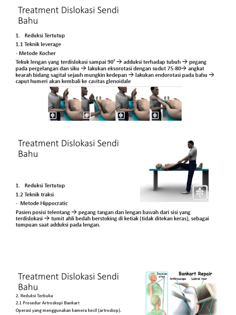 Treatment Dislokasi Sendi Bahu | PDF