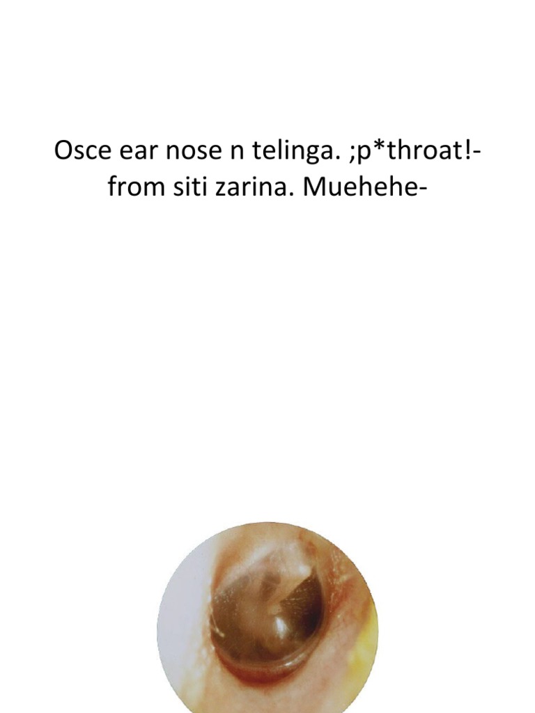 Osce Ent | PDF | Ear | Otorhinolaryngology
